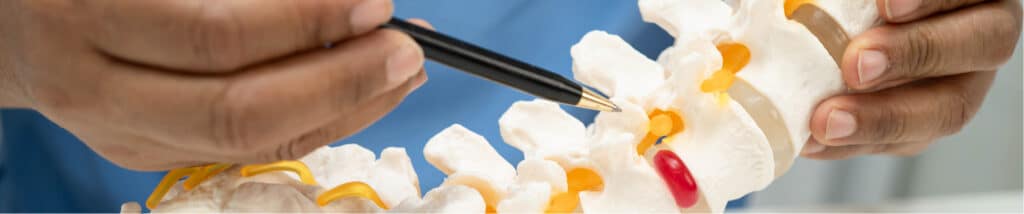 Spine Surgery Specialist East Brunswick, NJ